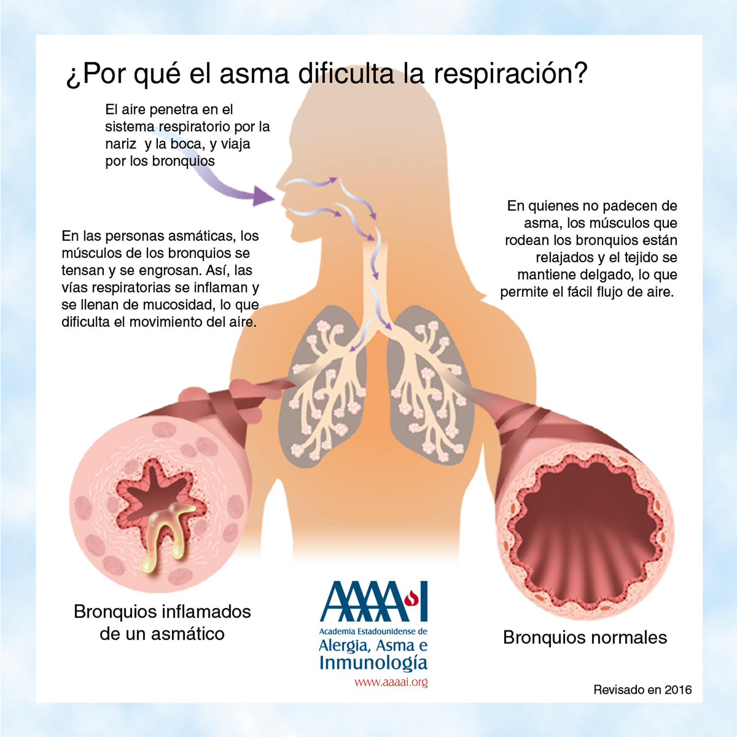 Asthma Infographics